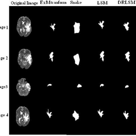 Results Of Boundary Detection Methods Column 1 Original Image