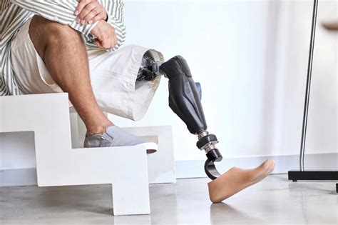 K Levels For Prosthetics Assessing Rehabilitation Potential