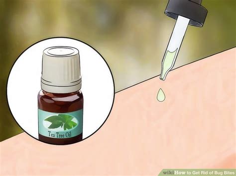 Ways To Get Rid Of Bug Bites WikiHow Ways To Get Rid Of Bug Bites WikiHow