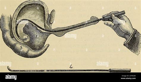 Diseases Of The Bladder And Prostate And Obscure Affections Of The