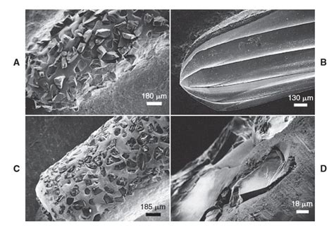 Tooth Preparation 2 Шүд засах явцад зөөлцөд гэмтэл учруулах шалтгаан By Gantumur Dds Medium