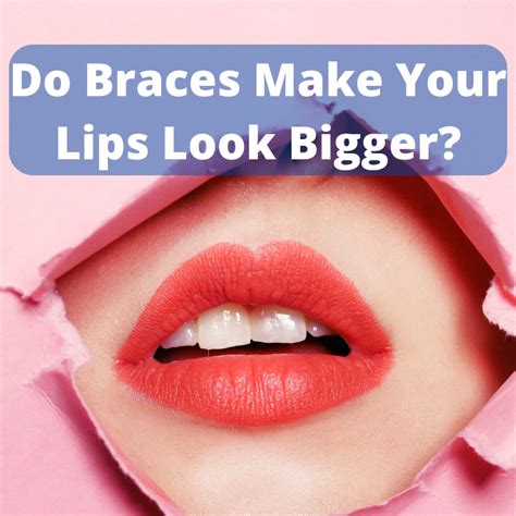 How To Make Your Lips Look Bigger With Braces Lipstutorial Org