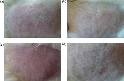 Transdermal Formulation Skin Irritation Testing Cd Formulation