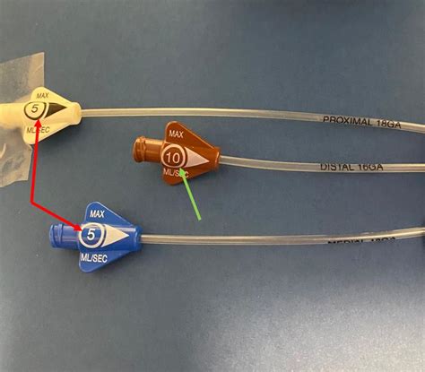 Triple Lumen Catheter Proximal Medial And Distal