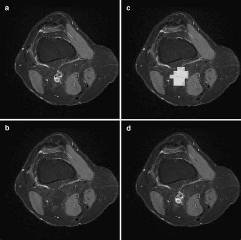 Tamper Localization And Recovery After Replacing A Part Oif Roi A Download Scientific Diagram