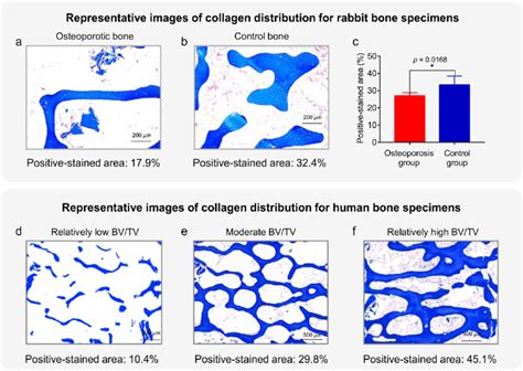 Histological Results With Collagen Quantification Obtained Using