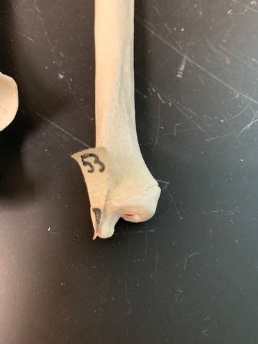 Ulna Flashcards Quizlet