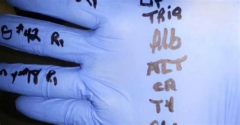 Medical Laboratory And Biomedical Science A Memo Of A Laboratorian