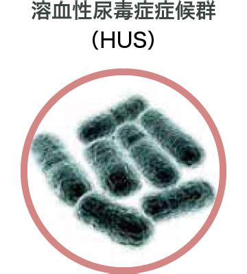 aHUS Sourceどんな検査をするの