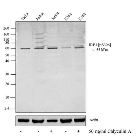 Phospho Irf3 Ser396 Antibody 720012