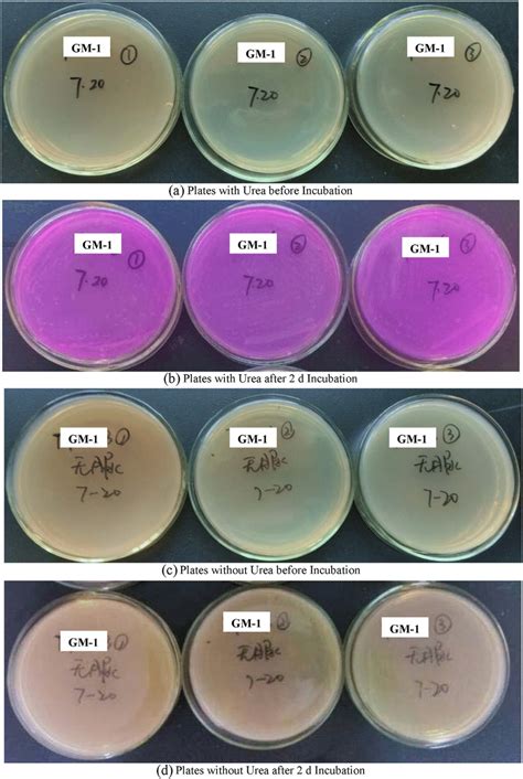 Urea Agar Results