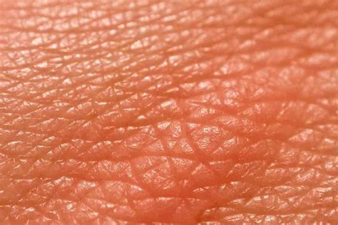 Дистрофія шкіри —