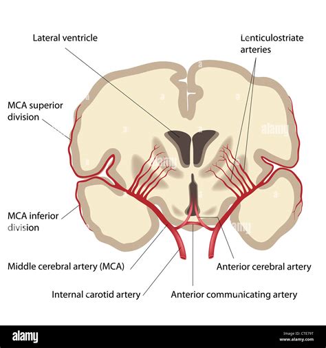 Cerebral Artery Anatomy