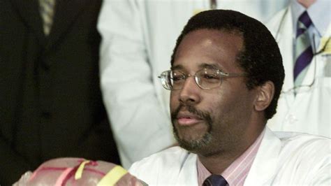 Craniopagus Twins Separated By Ben Carson