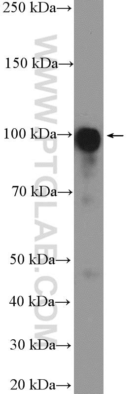 Lonp2 Antibody 18035 1 Ap Proteintech