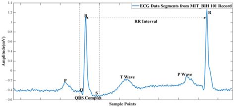 Sensors Free Full Text A Novel Instruction Driven 1 D Cnn Processor