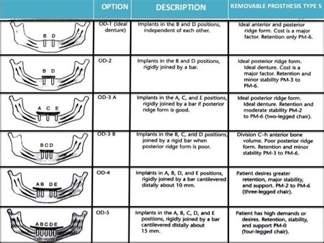 Implant Supported Overdentures
