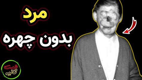 این مرد صورت نداشت ریموند رابینسون Youtube