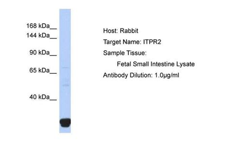 Ip3 Receptor 2 Polyclonal Antibody Invitrogen 100 μl Unconjugated