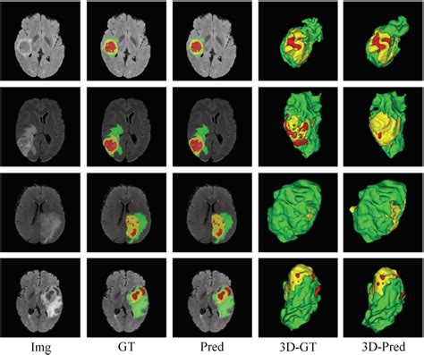 Segmentation Examples From The Training Set Download Scientific Diagram