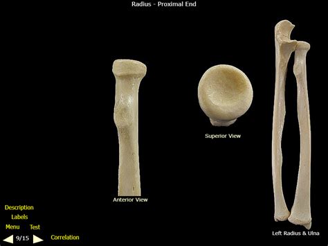 Proximal Radius Diagram Quizlet