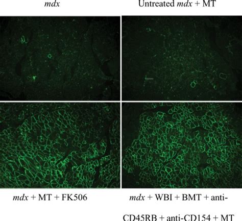 Representative Dystrophin Expression In Tibialis Anterior Ta Muscle Download Scientific