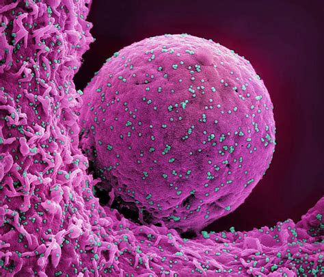 Clinical Trial To Test Immune Modulation Strategy For Hospitalized