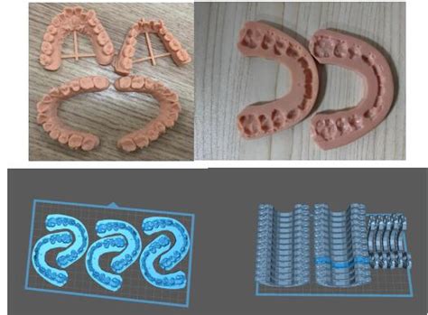 牙科3D打印机 首选立体易 中国3D打印网