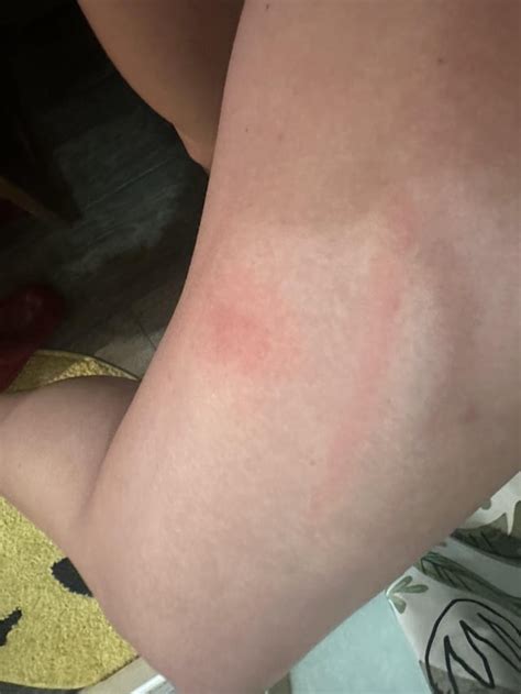 Bite From Cicadia Killer R Yiffbite