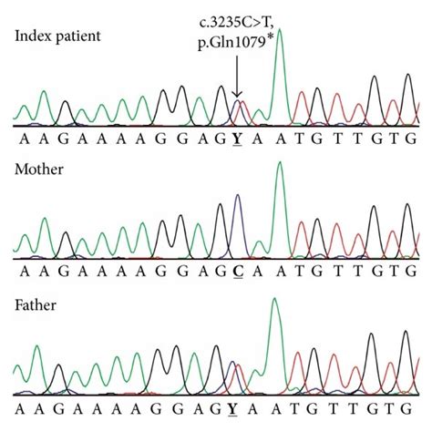 sequence analysis of the index patient showing the novel mutation
