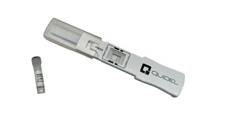 An New Test For Pink Eye At The Optometrist