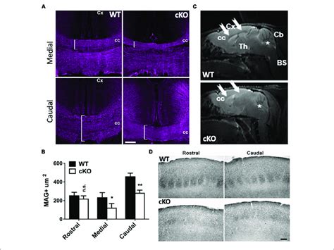 Corpus Callosum Dysgenesis And Disrupted Targeting Of Callosal