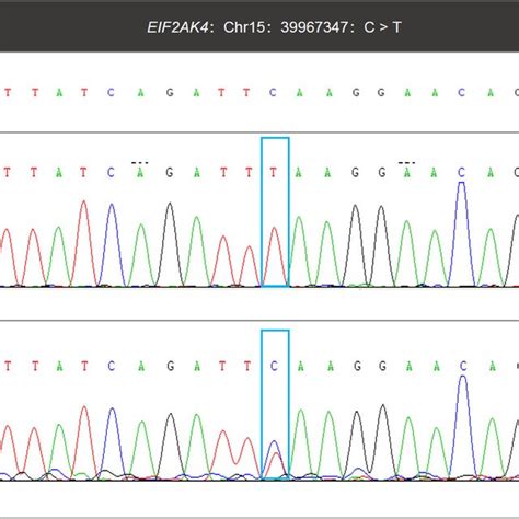 Representative Electropherogram Of Sanger Sequencing Identified An Download Scientific Diagram