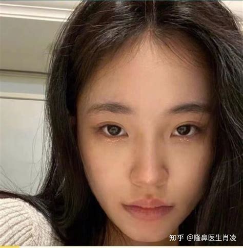 小S女儿也要隆鼻鼻头大千万不要盲目改善 知乎