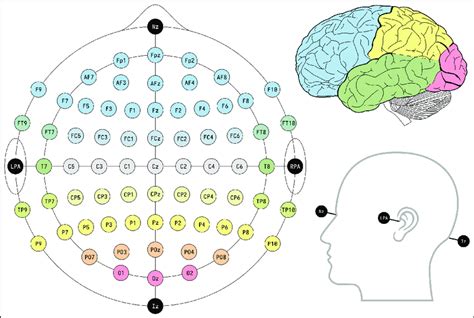 Normal Placement Of Electrodes According To The International 10 10