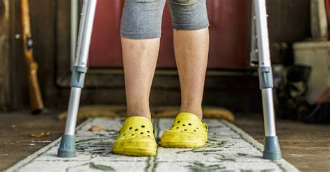 Broken Ankle Symptoms Causes Pictures Treatments And Rehab