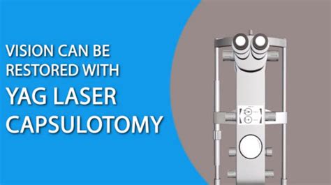 Yag Laser Capsulotomy A Minimally Invasive Treatment For Posterior