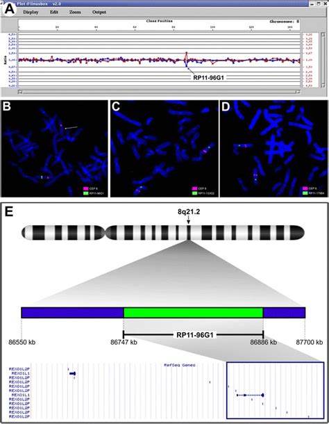 Microdeletion Characterization A For The Array Cgh Profile Of Download Scientific Diagram