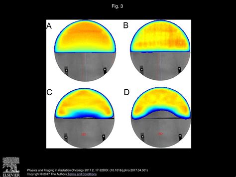 Surface Doses Of Flattening Filter Free Beams With Volumetric Modulated Arc Therapy Dose