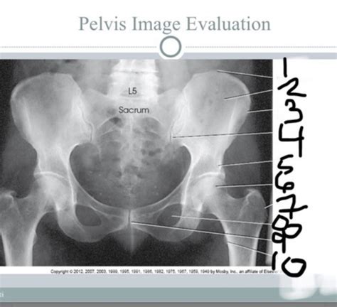 Lab Quiz Flashcards Quizlet