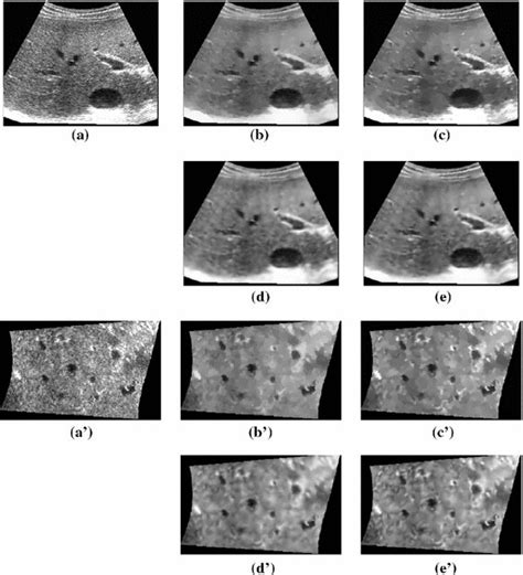 Denoising Results Of Our Proposed Models And Other Models On Real