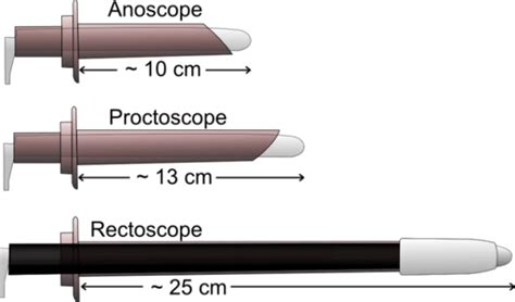 ¿qué Es Una Proctoscopia Y Cómo Se Realiza