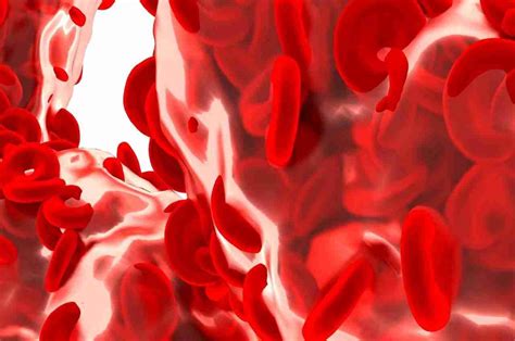 Hypertriglyceridemia Elevated Triglycerides Levels Causes