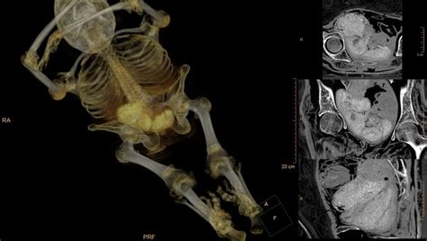 News New Study Analyzes Pregnant Egyptian Mummy Archaeology Magazine