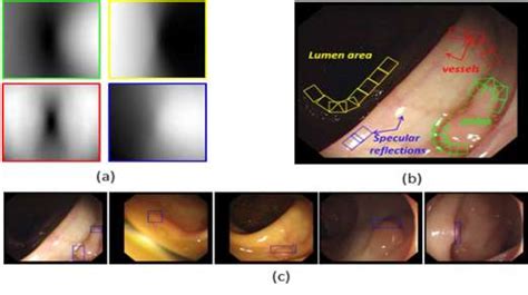 Figure 4 From The Image Segmentation And Polyp Detection In Colonoscopy