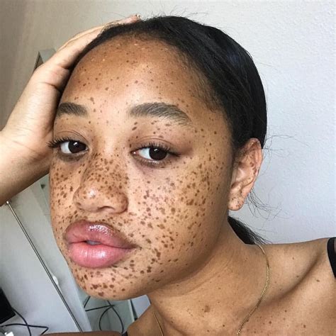How To Get Freckles With Dark Skin How To Do Thing Images And Photos Finder