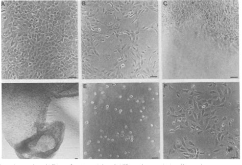 Figure 2 From The Platelet Glycoprotein Iibiiia Like Protein In Human