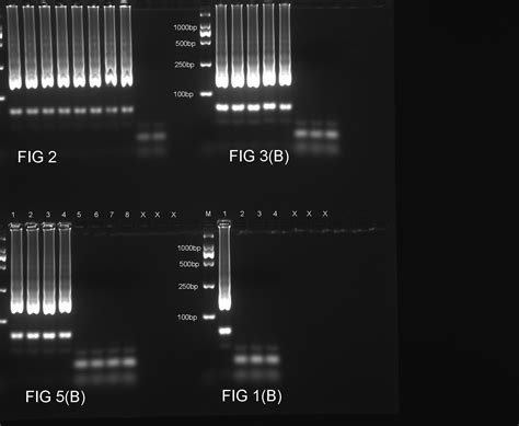 Figure 5 From Development Of A Loop Mediated Isothermal Amplification Assay Combined With A