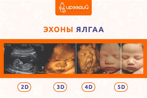 👉 Хэрэв та жирэмсэн Ирээдүй эмнэлэг Ireedui Emneleg