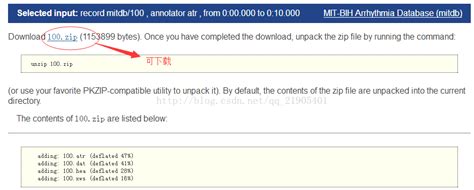 图解mit Bih数据库心电数据下载和matlab读取程序心电信号数据下载 Csdn博客